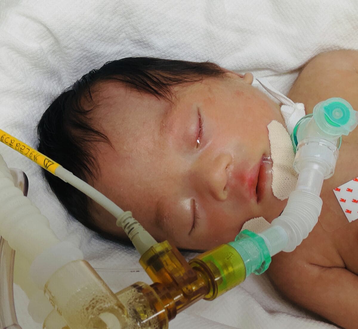 車にはねられた妊娠中の娘、死の間際に帝王切開で産んだ孫には重い障害、なのに「加害者は胎児への責任なし」だと？(5/5) | JBpress ...